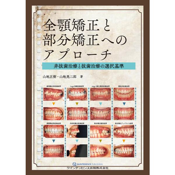 著:山地正樹　著:山地晃二郎出版社:クインテッセンス出版発売日:2022年05月キーワード:全顎矯正と部分矯正へのアプローチ非抜歯治療と抜歯治療の選択基準山地正樹山地晃二郎 ぜんがくきようせいとぶぶんきようせいえのあぷろーち ゼンガクキヨウ...