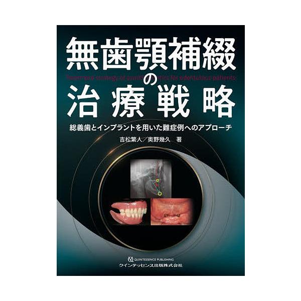 ※商品画像はイメージや仮デザインが含まれている場合があります。帯の有無など実際と異なる場合があります。著:吉松繁人　著:奥野幾久出版社:クインテッセンス出版発売日:2022年07月キーワード:無歯顎補綴の治療戦略総義歯とインプラントを用いた...