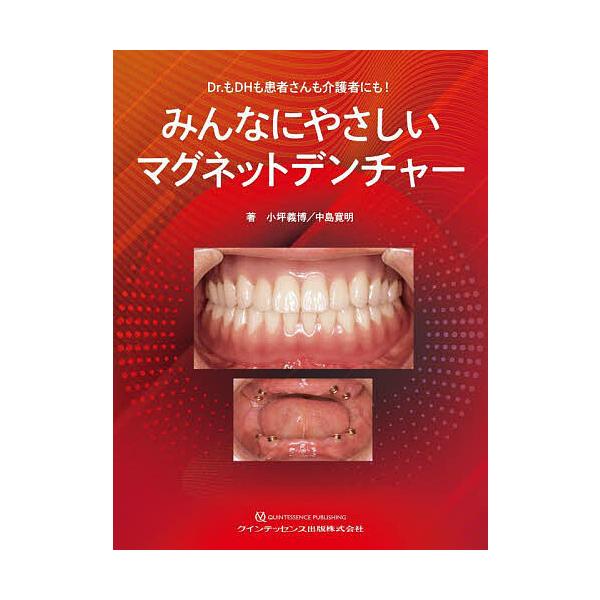 ※商品画像はイメージや仮デザインが含まれている場合があります。帯の有無など実際と異なる場合があります。著:小坪義博　著:中島寛明出版社:クインテッセンス出版発売日:2023年04月キーワード:みんなにやさしいマグネットデンチャーDr．もDH...