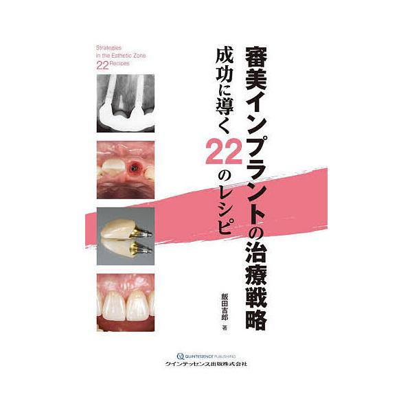 ※商品画像はイメージや仮デザインが含まれている場合があります。帯の有無など実際と異なる場合があります。著:飯田吉郎出版社:クインテッセンス出版発売日:2023年09月キーワード:審美インプラントの治療戦略成功に導く２２のレシピ飯田吉郎 しん...