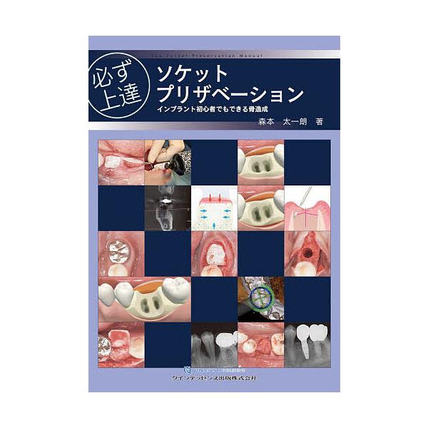 ※商品画像はイメージや仮デザインが含まれている場合があります。帯の有無など実際と異なる場合があります。著:森本太一朗出版社:クインテッセンス出版発売日:2024年06月キーワード:必ず上達ソケットプリザベーションインプラント初心者でもできる...