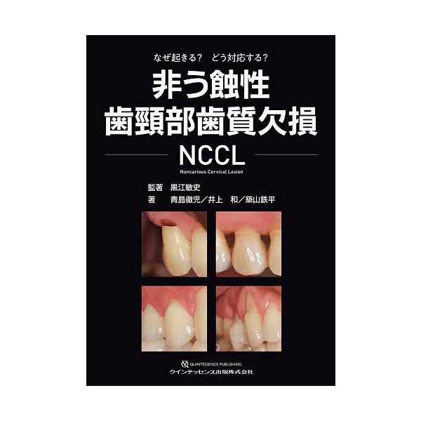 ※商品画像はイメージや仮デザインが含まれている場合があります。帯の有無など実際と異なる場合があります。監:黒江敏史　著:著青島徹児　著:井上和出版社:クインテッセンス出版発売日:2024年09月キーワード:非う蝕性歯頸部歯質欠損NCCLなぜ...