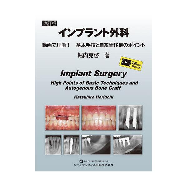 ※商品画像はイメージや仮デザインが含まれている場合があります。帯の有無など実際と異なる場合があります。著:堀内克啓出版社:クインテッセンス出版発売日:2024年10月キーワード:インプラント外科動画で理解！基本手技と自家骨移植のポイント堀内...