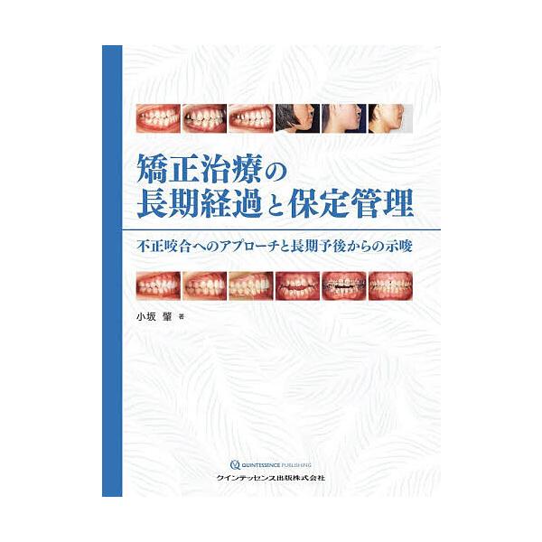 ※商品画像はイメージや仮デザインが含まれている場合があります。帯の有無など実際と異なる場合があります。著:小坂肇出版社:クインテッセンス出版発売日:2025年11月キーワード:矯正治療の長期経過と保定管理不正咬合へのアプローチと長期予後から...