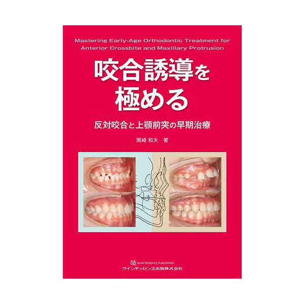 ※商品画像はイメージや仮デザインが含まれている場合があります。帯の有無など実際と異なる場合があります。著:関崎和夫出版社:クインテッセンス出版発売日:2026年10月キーワード:咬合誘導を極める反対咬合と上顎前突の早期治療関崎和夫 こうごう...