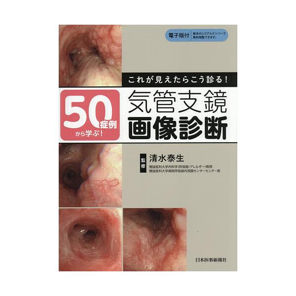 ※商品画像はイメージや仮デザインが含まれている場合があります。帯の有無など実際と異なる場合があります。監修:清水泰生出版社:日本医事新報社発売日:2026年03月キーワード:５０症例から学ぶ！これが見えたらこう診る！気管支鏡画像診断清水泰生...