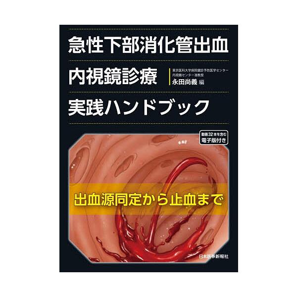 ※商品画像はイメージや仮デザインが含まれている場合があります。帯の有無など実際と異なる場合があります。編:永田尚義出版社:日本医事新報社発売日:2026年02月キーワード:急性下部消化管出血内視鏡診療実践ハンドブック出血源同定から止血まで永...