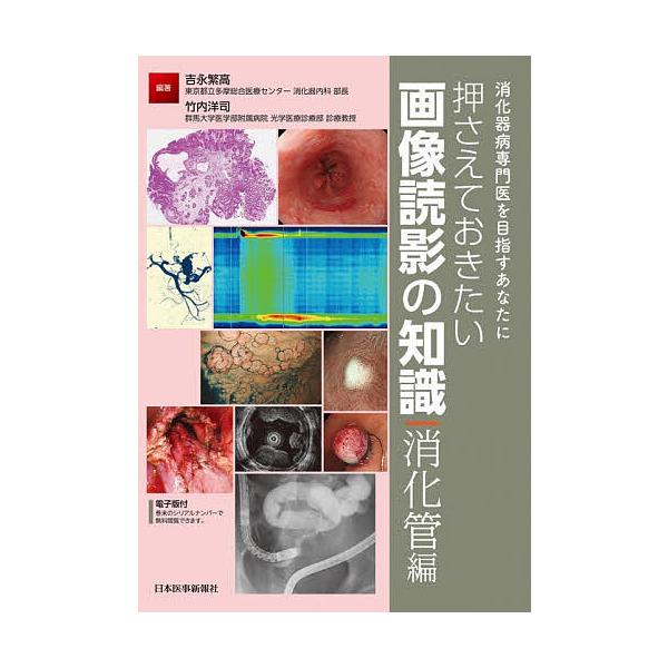 ※商品画像はイメージや仮デザインが含まれている場合があります。帯の有無など実際と異なる場合があります。編著:吉永繁高　編著:竹内洋司出版社:日本医事新報社発売日:2025年12月キーワード:押さえておきたい画像読影の知識消化器病専門医を目指...