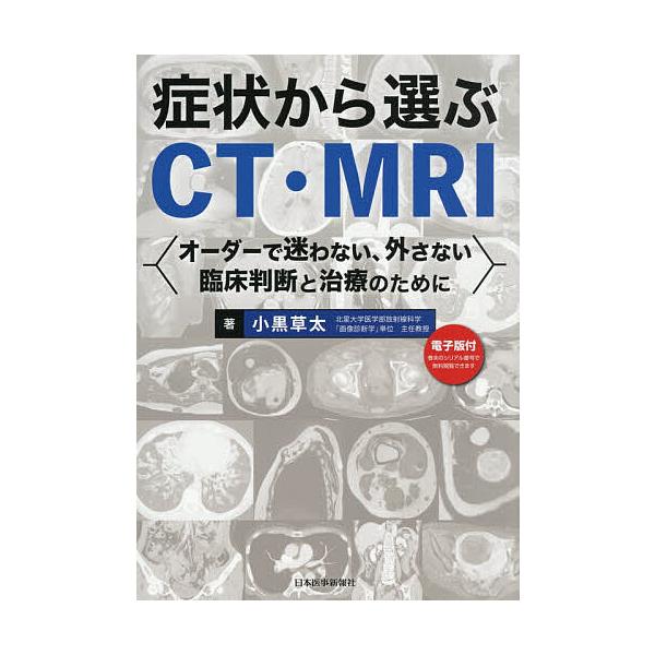 ※商品画像はイメージや仮デザインが含まれている場合があります。帯の有無など実際と異なる場合があります。著:小黒草太出版社:日本医事新報社発売日:2026年01月キーワード:症状から選ぶCT・MRIオーダーで迷わない、外さない臨床判断と治療の...