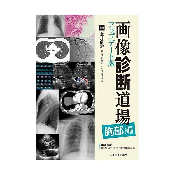 編著:金井信恭出版社:日本医事新報社発売日:2023年01月キーワード:画像診断道場アップデート版胸部編金井信恭 がぞうしんだんどうじようきようぶへんあつぷでーとば ガゾウシンダンドウジヨウキヨウブヘンアツプデートバ かない のぶやす カナ...