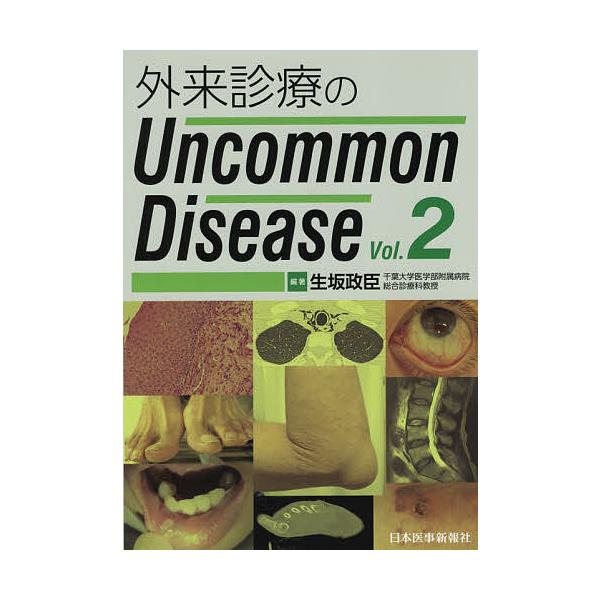 編著:生坂政臣出版社:日本医事新報社発売日:2017年09月巻数:2巻キーワード:外来診療のUncommonDiseaseVol．２生坂政臣 がいらいしんりようのあんこもんでいじーず２ ガイライシンリヨウノアンコモンデイジーズ２ いくさか ...