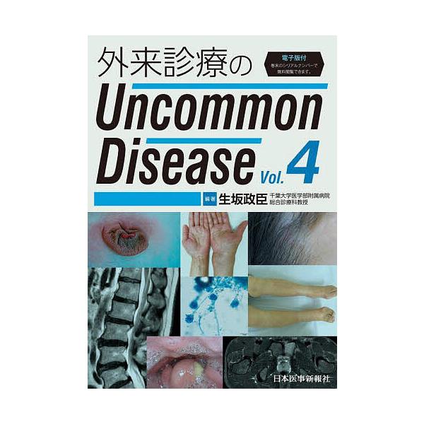 編著:生坂政臣出版社:日本医事新報社発売日:2023年10月巻数:4巻キーワード:外来診療のUncommonDiseaseVol．４生坂政臣 がいらいしんりようのあんこもんでいじーず４ ガイライシンリヨウノアンコモンデイジーズ４ いくさか ...