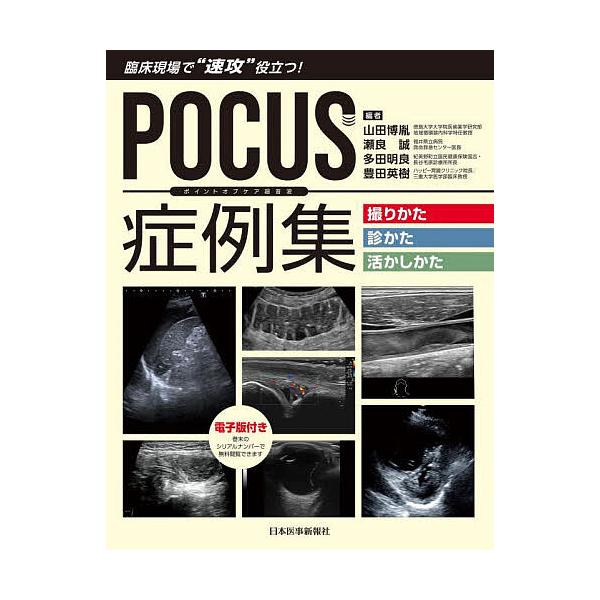 編:山田博胤　編:瀬良誠　編:多田明良出版社:日本医事新報社発売日:2022年11月キーワード:POCUS症例集撮りかた・診かた・活かしかた臨床現場で“速攻”役立つ！山田博胤瀬良誠多田明良 ぽーかすしようれいしゆうとりかたみかたいかしかたぽ...