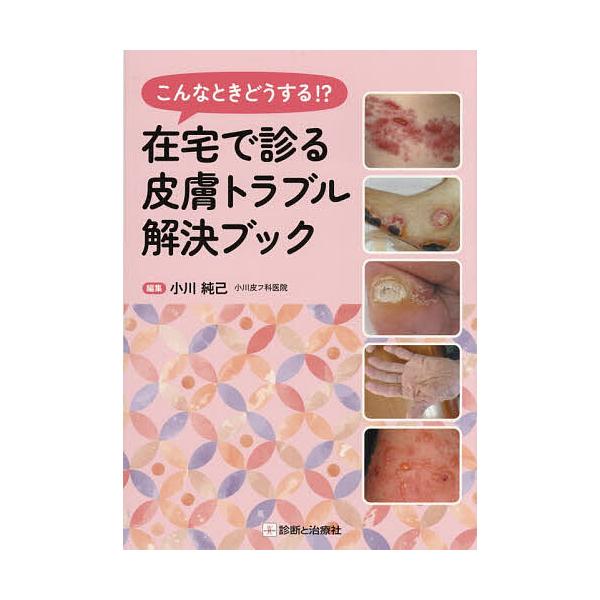 ※商品画像はイメージや仮デザインが含まれている場合があります。帯の有無など実際と異なる場合があります。編集:小川純己出版社:診断と治療社発売日:2026年03月キーワード:こんなときどうする！？在宅で診る皮膚トラブル解決ブック小川純己 こん...