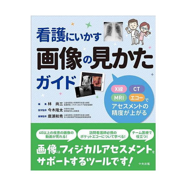 ※商品画像はイメージや仮デザインが含まれている場合があります。帯の有無など実際と異なる場合があります。編集:林尚三　医学監修:今木隆太　画:廣瀬和秀出版社:中央法規出版発売日:2022年07月キーワード:看護にいかす画像の見かたガイドX線・...