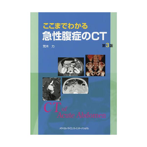 著:荒木力出版社:メディカル・サイエンス・インターナショナル発売日:2018年09月キーワード:ここまでわかる急性腹症のCT荒木力 ここまでわかるきゆうせいふくしようのしーていーここ ココマデワカルキユウセイフクシヨウノシーテイーココ あら...