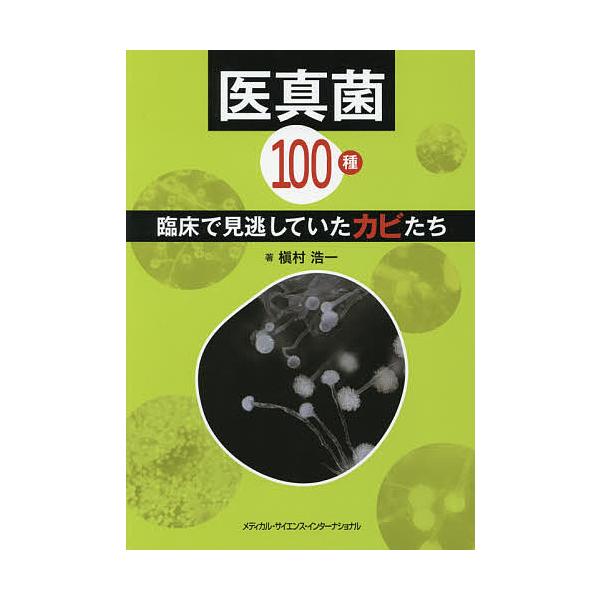 著:槇村浩一出版社:メディカル・サイエンス・インターナショナル発売日:2019年02月キーワード:医真菌１００種臨床で見逃していたカビたち槇村浩一 いしんきんひやくしゆいしんきん／１００しゆりんしよ イシンキンヒヤクシユイシンキン／１００シ...