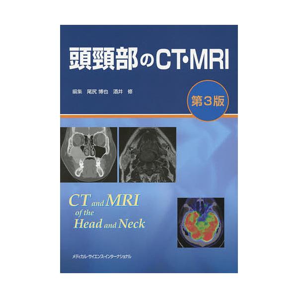 編集:尾尻博也　編集:酒井修出版社:メディカル・サイエンス・インターナショナル発売日:2019年04月キーワード:頭頸部のCT・MRI尾尻博也酒井修 とうけいぶのしーていーえむあーるあいとうけいぶ／の トウケイブノシーテイーエムアールアイト...