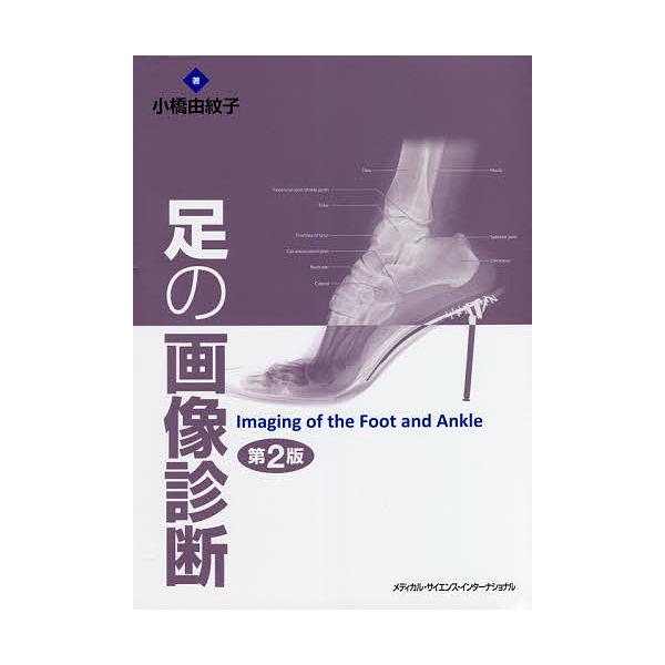 著:小橋由紋子出版社:メディカル・サイエンス・インターナショナル発売日:2021年09月キーワード:足の画像診断小橋由紋子 あしのがぞうしんだん アシノガゾウシンダン こばし ゆうこ コバシ ユウコ