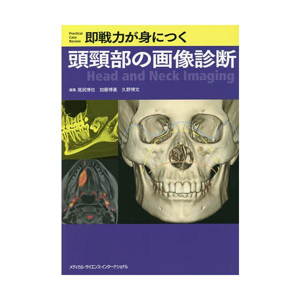 編集:尾尻博也　編集:加藤博基　編集:久野博文出版社:メディカル・サイエンス・インターナショナル発売日:2021年09月キーワード:即戦力が身につく頭頸部の画像診断尾尻博也加藤博基久野博文 そくせんりよくがみにつくとうけいぶの ソクセンリヨ...