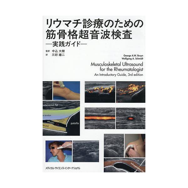 ※商品画像はイメージや仮デザインが含まれている場合があります。帯の有無など実際と異なる場合があります。出版社:メディカル・サイエンス・インターナショナ発売日:2026年04月キーワード:リウマチ診療のための筋骨格超音波検査 りうまちしんりよ...