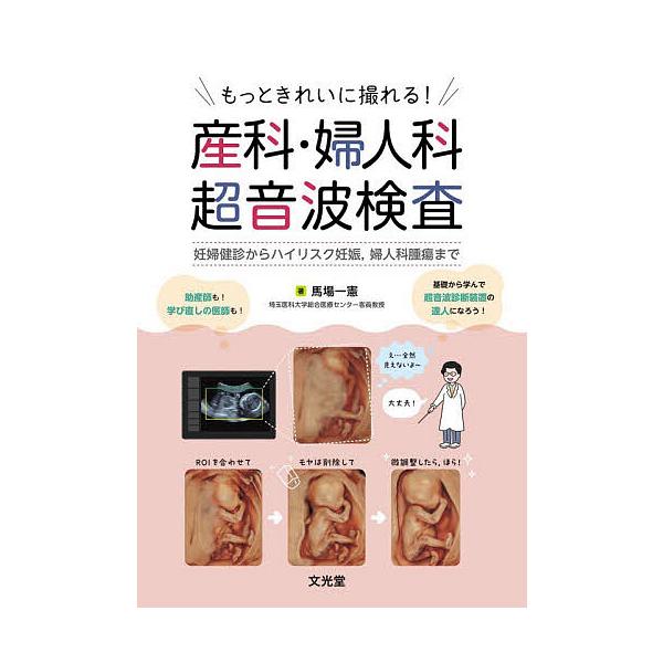 ※商品画像はイメージや仮デザインが含まれている場合があります。帯の有無など実際と異なる場合があります。著:馬場一憲出版社:文光堂発売日:2026年05月キーワード:もっときれいに撮れる！産科・婦人科超音波検査妊婦健診からハイリスク妊娠，婦人...