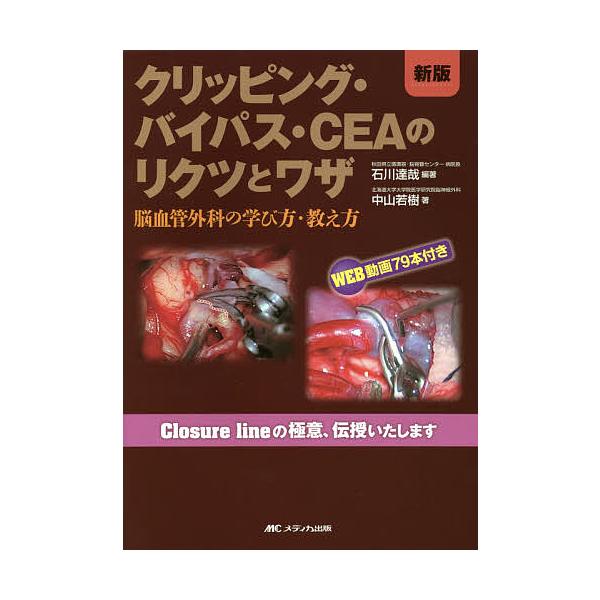 ※商品画像はイメージや仮デザインが含まれている場合があります。帯の有無など実際と異なる場合があります。編著:石川達哉　著:中山若樹出版社:メディカ出版発売日:2019年04月キーワード:クリッピング・バイパス・CEAのリクツとワザ脳血管外科...