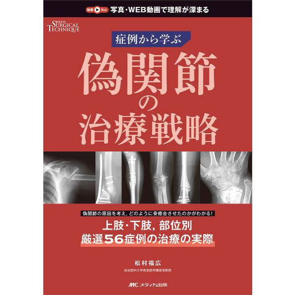 ※商品画像はイメージや仮デザインが含まれている場合があります。帯の有無など実際と異なる場合があります。著:松村福広出版社:メディカ出版発売日:2022年04月キーワード:偽関節の治療戦略症例から学ぶ松村福広 ぎかんせつのちりようせんりやくせ...