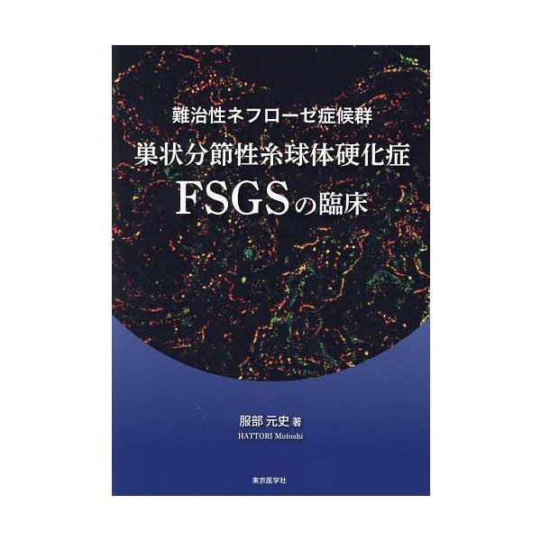 ※商品画像はイメージや仮デザインが含まれている場合があります。帯の有無など実際と異なる場合があります。著:服部元史出版社:東京医学社発売日:2023年06月キーワード:難治性ネフローゼ症候群巣状分節性糸球体硬化症FSGSの臨床服部元史 なん...