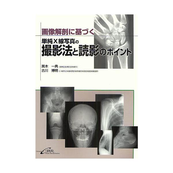 ※商品画像はイメージや仮デザインが含まれている場合があります。帯の有無など実際と異なる場合があります。著:黒木一典　著:古川博明出版社:シービーアール発売日:2009年05月シリーズ名等:画像解剖に基づくキーワード:画像解剖に基づく単純X線...