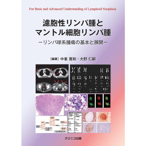 ※商品画像はイメージや仮デザインが含まれている場合があります。帯の有無など実際と異なる場合があります。編著:中峯寛和　編著:大野仁嗣出版社:クリニコ出版発売日:2025年04月キーワード:濾胞性リンパ腫とマントル細胞リンパ腫リンパ球系腫瘍の...