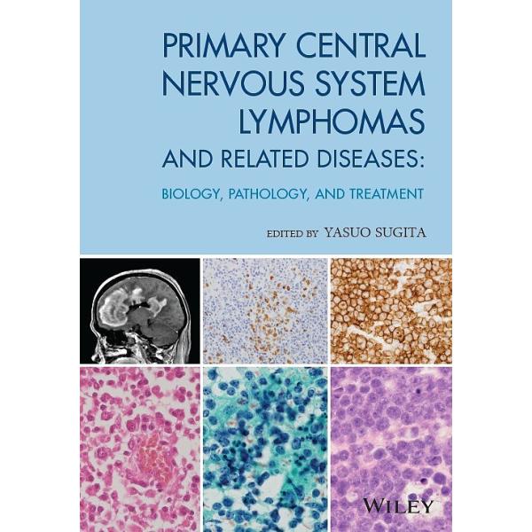 編:YasuoSugita出版社:WILEY発売日:2019年11月キーワード:PRIMARYCENTRALNERVOUSSYSTEMLYMPHOMASANDRELATEDDISEASESBIOLOGY，PATHOLOGY，ANDTREAT...