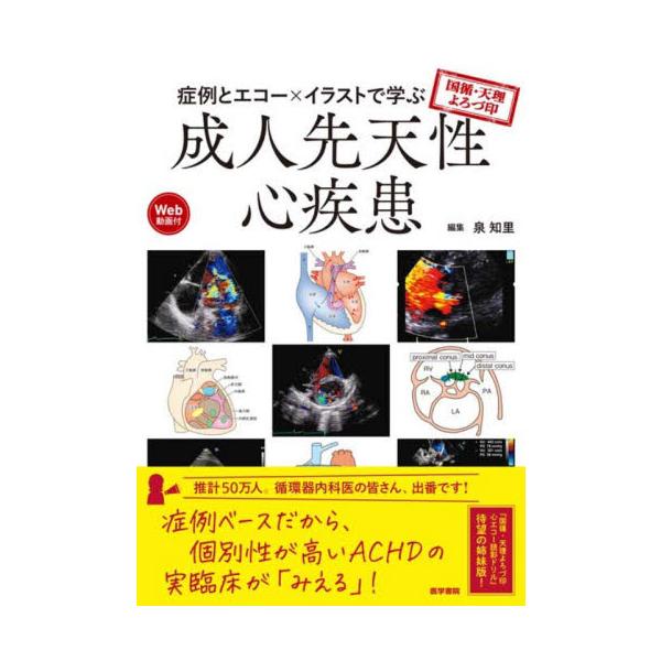 「国循・天理よろづ印　心エコー読影ドリル」姉妹版！ 心房中隔欠損症、肺動脈弁狭窄症、房室中隔欠損症、動脈管開存症、右室二腔症、ファロー四徴症、Ebstein病、アイゼンメンジャー症候群、Ross手術後、修正大血管転位、両大血管右室起始、右室...