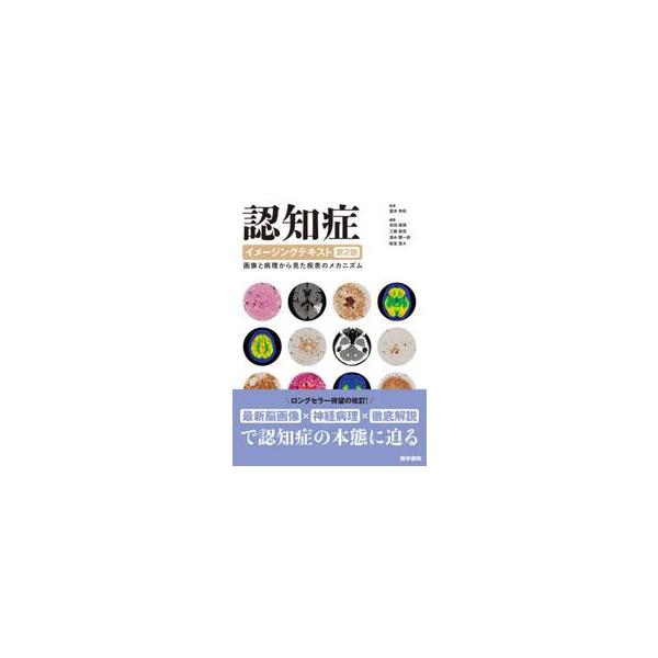 認知症のロングセラー、待望の改訂！<br>ビジュアルで「理解できる」と高い評価を得たロングセラー書籍が、最新の知見を取り入れてさらに進化。<br>抗アミロイドβ抗体薬の実臨床への導入や、バイオマーカー研究の進歩など、...