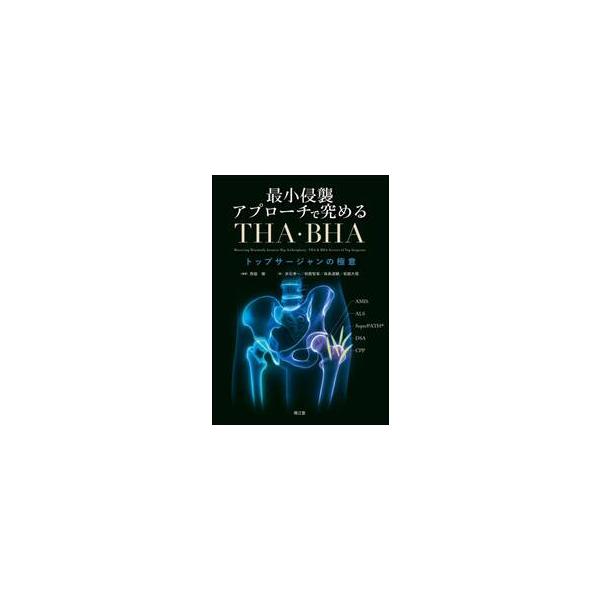 初めて筋腱や軟部組織を温存する最小侵襲手術（MIS）の安全な執刀を目的に，第一人者によるノウハウを豊富なイラストで詳述する．初めて筋腱や軟部組織を温存する最小侵襲手術（MIS）を行う術者が安全に執刀できるようになることを目的に，各進入法の第...