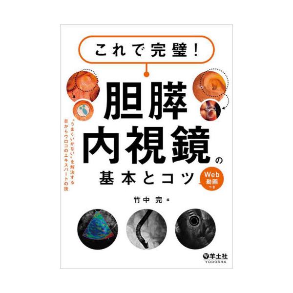 ERCP・EUSのスキルをグッと上げる完璧本！web動画付き「うまく胆管挿管できない」「ステントを留置できない」といった手技中のモヤモヤをすっきりさせる完璧ポイントを画像・動画とともに解説．「口側隆起にCDをイメージ」「ESTはグーチョキパ...