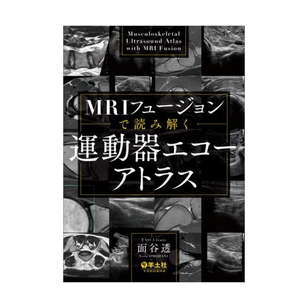史上初！MRIとの対比に振り切った運動器エコー正常像アトラスMRIとのフュージョンで解剖のイメージはこんなにもエコーに落とし込める！<br>運動器全領域にわたり約260部分へのプローブの当て方，MRI画像，エコー画像を掲載し，対...