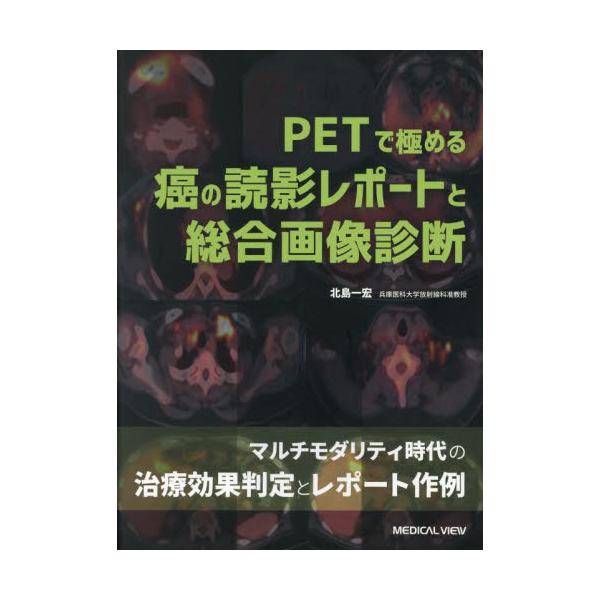 癌の放射線診断における総合的な画像診断の進め方を丁寧に解説。臨床医とのディスカッションやカンファレンスに必携！CT/MRI/PET による癌のステージングや治療効果判定を，症例ベースにTNM分類やRECIST/PERCISTに沿ってわかりや...