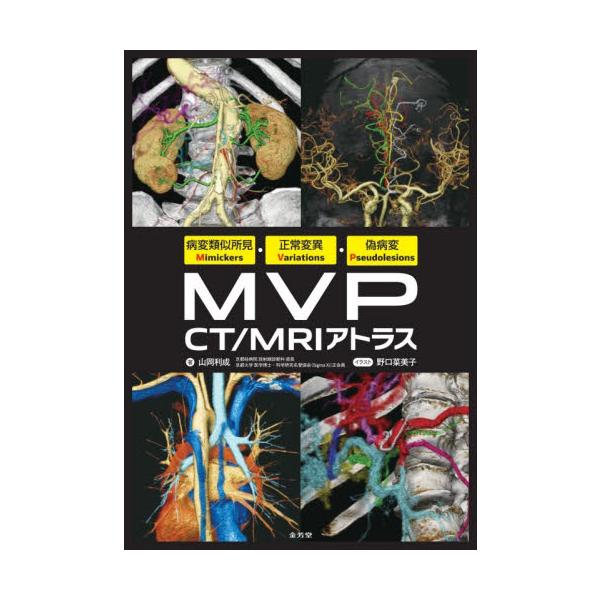 「これって本当に病変？」日々の読影で迷う正常変異・偽病変を完全網羅。過剰診療を防ぎ、確信を持った診断へ。IVRの安全性を高め、3D画像作成のお手本にもなる、画像診断医必携の「MVP」アトラス。<br>山岡利成金芳堂2026年04...