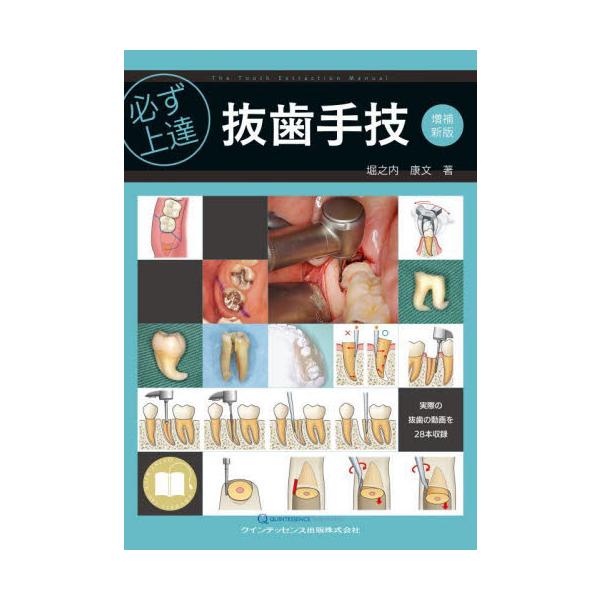 本書の第一版は、2012年には韓国語版が、2020年には中国語版が出版され、本書の内容は国内外の読者にも認めていただいているようです。抜歯に対する誤解・問題点を熟知した筆者が、若手歯科医師や抜歯が苦手な先生方が独習でマスターできるようにとの...
