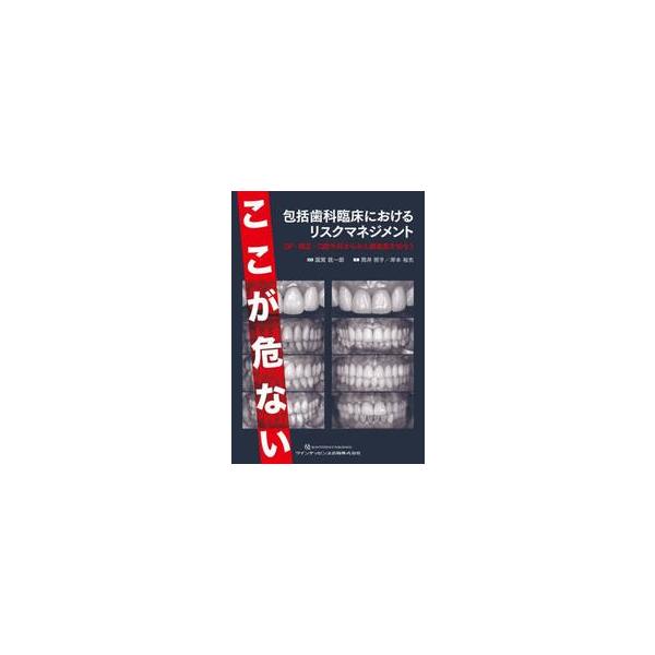 包括歯科臨床にこだわる筆者（編著者）渾身の多くの長期経過症例から導き出されたリスクマネジメント。GP・矯正・口腔外科の視点から「個体差に起因する力（機能）と炎症のコントロール」について、症例に即してわかりやすく解説することを試みた。主訴対応...
