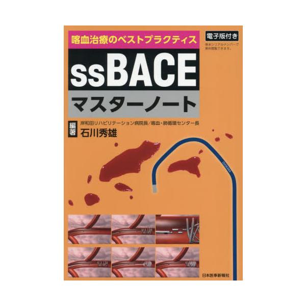 喀血に対するカテーテル治療である気管支動脈塞栓術（BAE）を累計3800例以上経験し，最新のエビデンスを世界に向けて発信しつづける喀血治療の第一人者，石川秀雄先生を編者に迎え，制作した喀血治療の完全ガイド！<br>石川秀雄先生ほ...