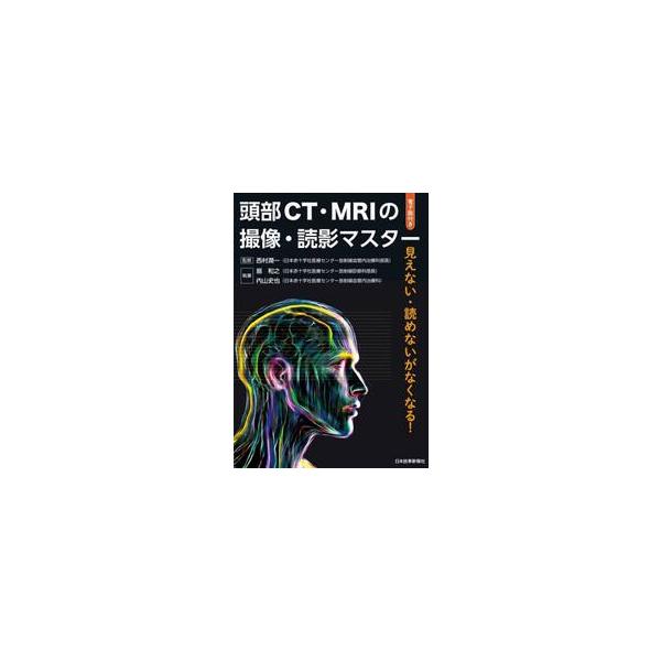 ・頭部疾患の的確な診断・評価のために，押さえておきたい基本と重要知識をコンパクトにまとめた実践ガイド！解剖学や読影の基礎を丁寧に解説しつつ，最新の撮像技術や進歩した診断ノウハウをふんだんに盛り込みました。<br>・50以上の頭部...