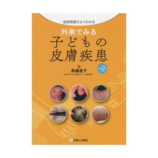 子どもの皮膚疾患の症例写真がわかりやすくまとまった書籍．改訂にあたり，最新の症例にも対応し，症例写真200点以上を新たに収録．今でも通常の外来診療では，皮膚疾患は目で診て診断をつけることが大半で，できるだけ多くの症例を経験し診る目を養うとい...