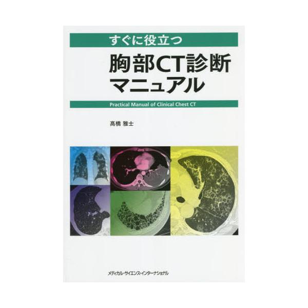 胸部CTの読影、診断のポイントを初学者にもわかりやすく解説。画像診断に必要な胸部の解剖の知識を踏まえたうえで、肺野・縦隔病変の基本的な画像所見を示し鑑別診断の考え方を伝授する。CTが重要な役割を果たす疾患に関して直近にCT画像を示し、箇条書...
