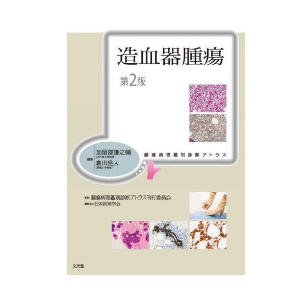 血液・骨髄病理のエキスパートが形態学的な特徴，診断の要点，鑑別診断のポイントを解説．WHO分類第5版（2024年）に対応．<br>加留部謙之輔文光堂2026年02月ゾウケツキシユヨウカルベケンノスケ/