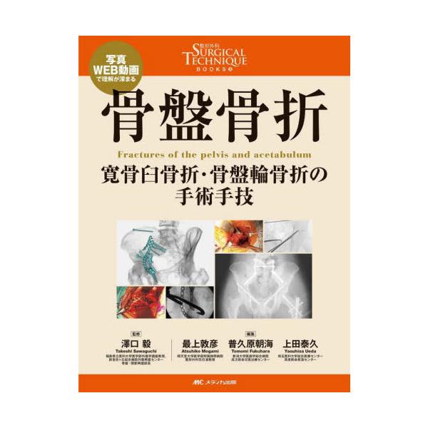 治療・手術の難易度の高い骨折として知られる「骨盤骨折（寛骨臼骨折・骨盤輪骨折）」について、最新の治療をまとめた実践テキスト。写真、シェーマでわかりやすく解説するとともに、web動画で実際の手術手技を確認できる。骨折の分類はもちろん、寛骨臼骨...