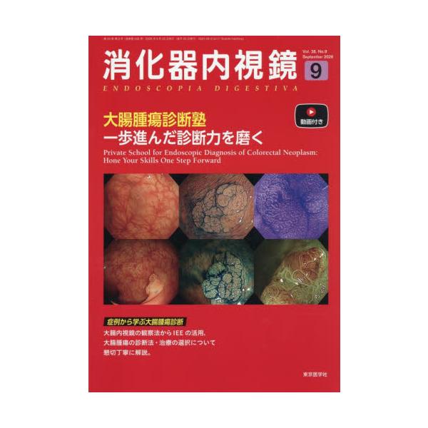 <br>消化器内視鏡編集委員会／編集東京医学社2026年09月シヨウカキ　ナイシキヨウ　３８?９（２０２６?９）　３８?９（２０２６?９）　ダイチヨウ　シユヨウ　シンダンジユクトウキヨウ／イガクシヤ/