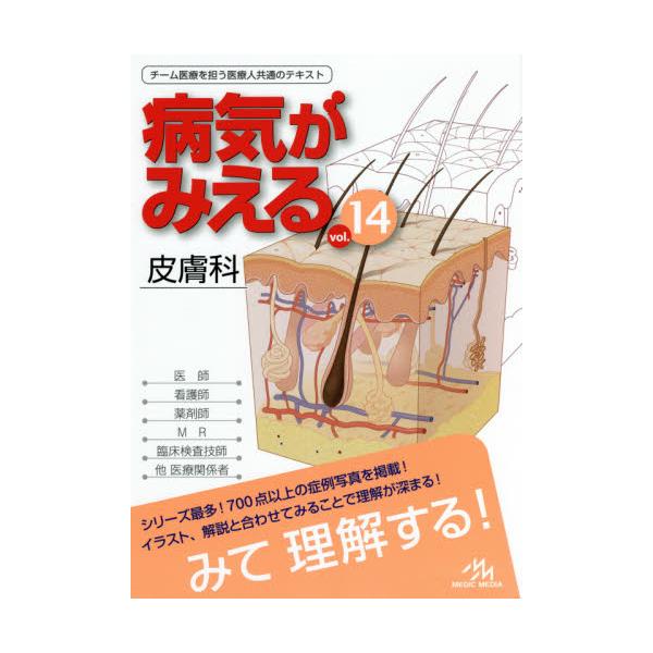 大人気『病気がみえる』シリーズに皮膚科が登場。シリーズ最多の画像掲載数です。写真を並べただけでなく、病みえシリーズならではのわかりやすいイラストと、丁寧な解説で、皮膚疾患が「みてわかる」１冊。アトピー性皮膚炎、乾癬、水疱症、悪性黒色腫などの...