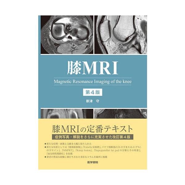※商品画像はイメージや仮デザインが含まれている場合があります。帯の有無など実際と異なる場合があります。著:新津守出版社:医学書院発売日:2026年04月キーワード:膝MRI新津守 ひざえむあーるあいひざ／ＭＲＩ ヒザエムアールアイヒザ／ＭＲ...